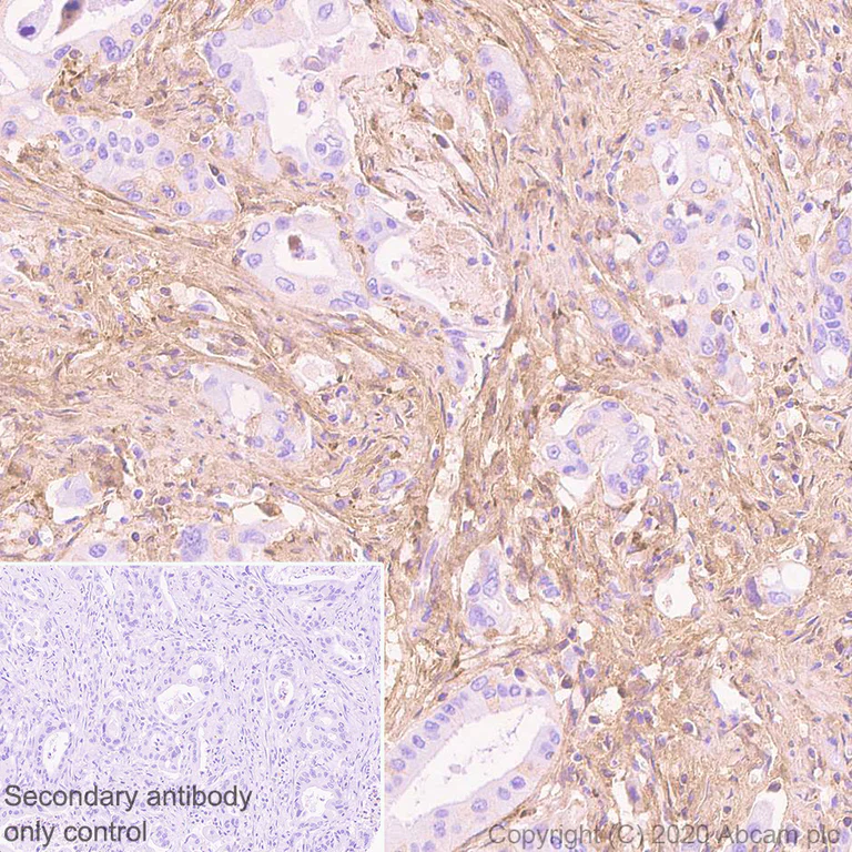 Anti-Pro-Collagen III alpha 1 antibody [EPR24255-13] (ab279338) | Abcam