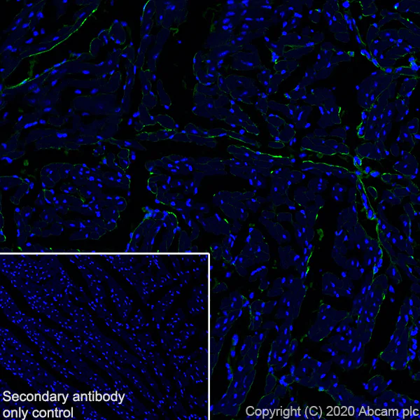 Anti-Pro-Collagen III alpha 1 antibody [EPR24257-57] (ab278080) | Abcam