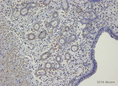 Progesterone Receptor抗体 (ab63605)| Abcam中文官网