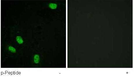 Anti-Progesterone Receptor (phospho S294) antibody (ab61785) | Abcam