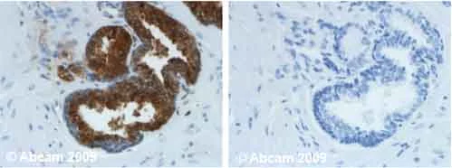Prostate Specific Antigen抗体[8301] (ab403)| Abcam中文官网