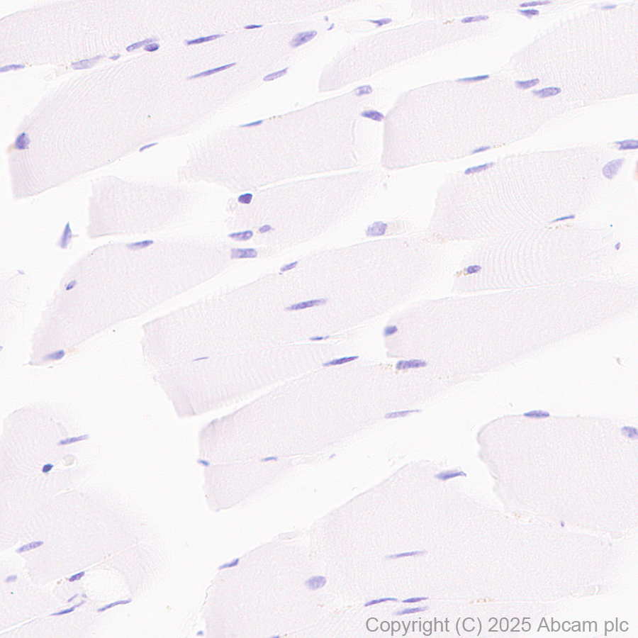 Anti-Prostate Specific Antigen antibody [EPR22271-97] - BSA and Azide ...