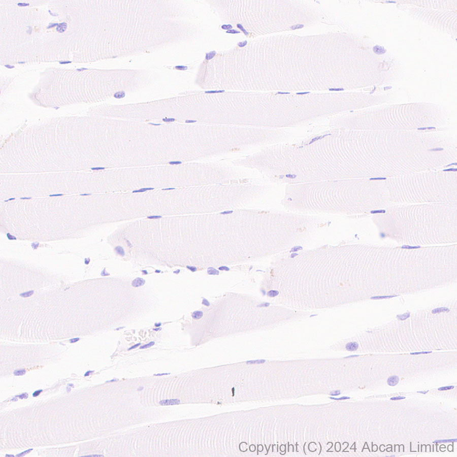 Anti-Prostate Specific Antigen antibody [RM1268] (ab322442) | Abcam