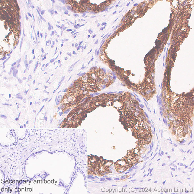 Anti-Prostate Specific Antigen antibody [RM1268] (ab322442) | Abcam