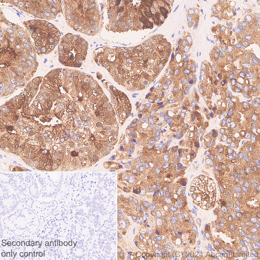 Anti-Prostate Specific Antigen antibody [RM1268] (ab322442) | Abcam