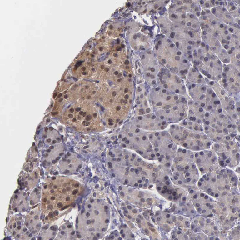 Anti-Proteasome 19S S4/PSMC1 抗体 (ab223765) | Abcam