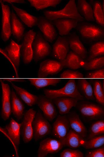 Anti-Proteasome 20S alpha 5/PSMA5 antibody (ab189855) | Abcam