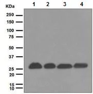 Proteasome 20S alpha 5/PSMA5抗体[EPR5833] (ab109533)| Abcam中文官网