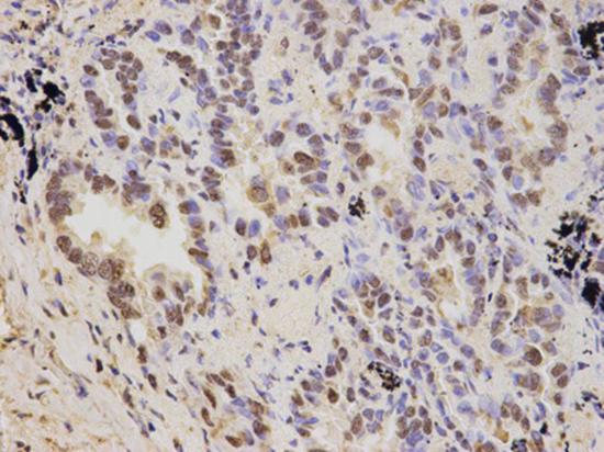 Anti-Proteasome 26S S2/PSMD2 antibody (ab197054) | Abcam