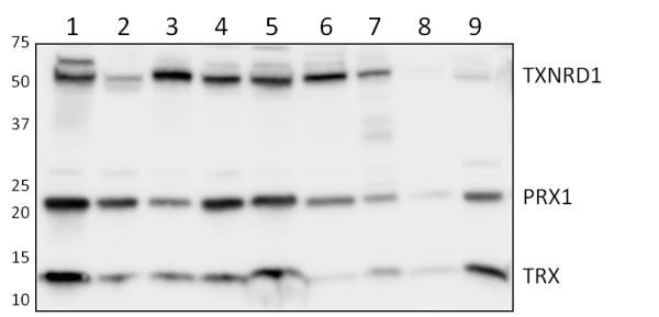 PRX Pathway (TRX, TXNRD1, PRX1) Western Blot Cocktail (ab184868) | Abcam