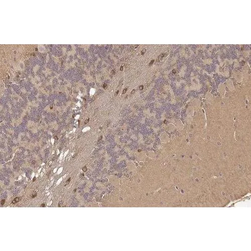 Anti-PSAT1 antibody [HL2270] (ab317185) | Abcam中文官网