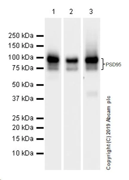 Anti-PSD95 antibody, synaptic Marker [EPR23124-118] (ab238135) | Abcam