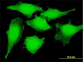 Anti-PSMB5/MB1 antibody. Rabbit polyclonal (ab3330) | Abcam