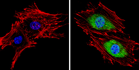 Anti-PSMB5/MB1 antibody. Rabbit polyclonal (ab3330) | Abcam
