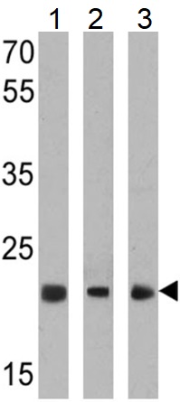 Anti-PSMB5/MB1 antibody. Rabbit polyclonal (ab3330) | Abcam