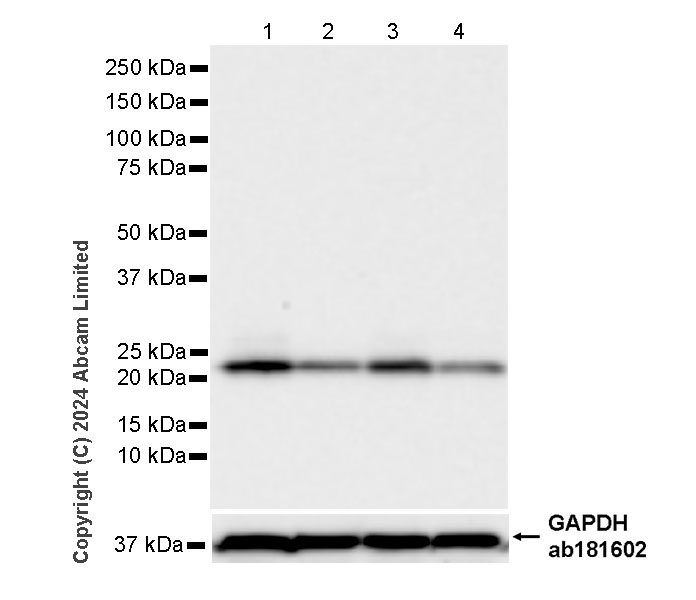 Anti-PSMB5/MB1 antibody [EPR28990-5] - BSA and Azide free (ab321798 ...