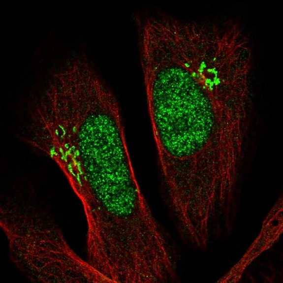 Anti-PSMD11 antibody (ab221645) | Abcam
