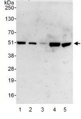 Anti-PSMD11 antibody (ab99414) | Abcam