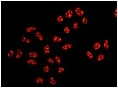 PTBP2抗体[EPR9890] (ab154787)| Abcam中文官网