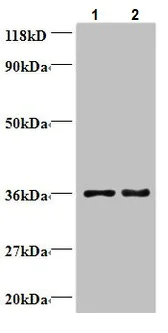 Anti-PTDSS1 antibody (ab237019) | Abcam