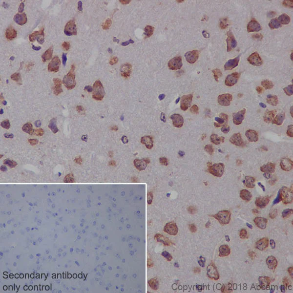 Anti-PTEN antibody [EPR9941-2] KO tested (ab170941) | Abcam