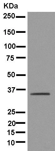 PTGR1抗体[EPR13451-10] (ab181131)| Abcam中文官网