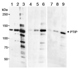 PTIP抗体 (ab70434)| Abcam中文官网