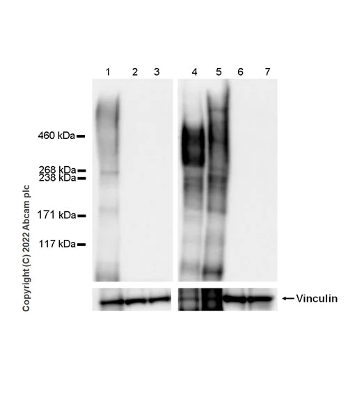 Anti-PTP zeta/ Phosphacan antibody [EPR26271-75] - BSA and Azide free ...
