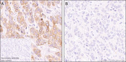 Anti-PTP1B (phospho S378) antibody [EP1840Y] - BSA and Azide free ...