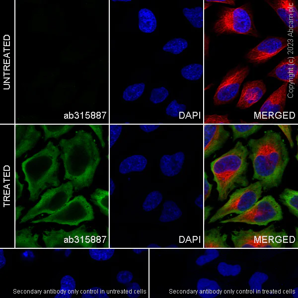 Puromycin抗体[EPR27218-173] (ab315887)| Abcam中文官网