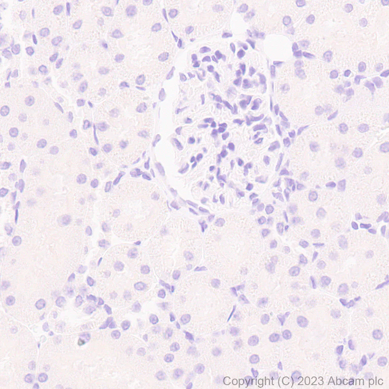 Anti-Puromycin antibody [EPR27218-173] - BSA and Azide free (ab315888 ...