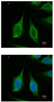 Anti-Pyrophosphatase 1 antibody (ab96099) | Abcam
