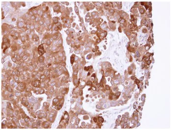 Anti-Pyrophosphatase 1 antibody (ab96099) | Abcam