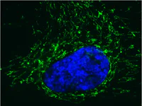 Anti-Pyruvate dehydrogenase E2/E3bp antibody [13G2AE2BH5] (ab110333 ...