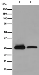 Anti-QDPR/DHPR antibody [EP12595] - BSA and Azide free (ab284839) | Abcam
