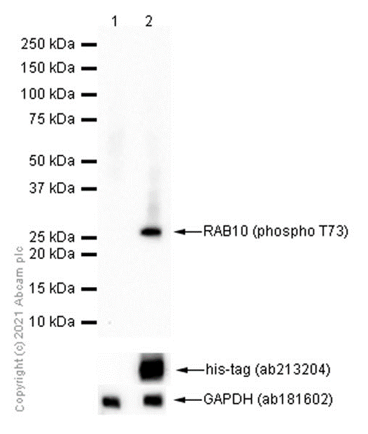 Anti-RAB10 (phospho T73) antibody [MJF-R21-22-5] (ab241060) | Abcam