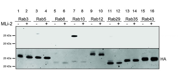 Anti-RAB10 (phospho T73) antibody [MJF-R21-22-5] (ab241060) | Abcam