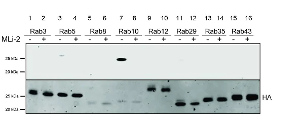 Anti-RAB10 (phospho T73) antibody [MJF-R21-22-5] (ab241060) | Abcam