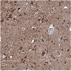 Anti-RAB12 antibody (ab122666) | Abcam