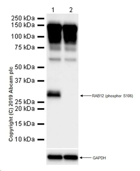 Anti-RAB12 (phospho S106) antibody [MJF-R25-9] (ab256487) | Abcam