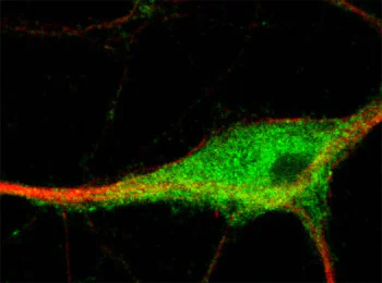 Anti-Rab4 antibody - Early Endosome Marker (ab13252) | Abcam
