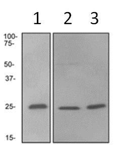 Anti-Rab4 antibody [EPR3042] - Early Endosome Marker (ab108974) | Abcam