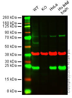Anti-Rab4 antibody [EPR3042] - Early Endosome Marker (ab108974) | Abcam