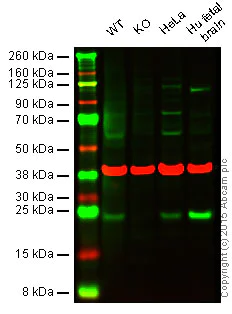 Anti-Rab4 antibody [EPR3043] - Early Endosome Marker (ab109009) | Abcam