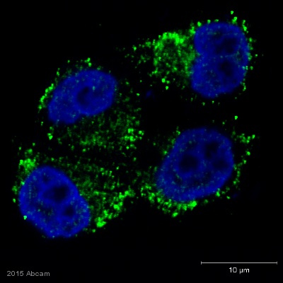 Anti-RAB7 antibody [Rab7-117] - Late Endosome Marker (ab50533) | Abcam