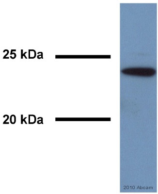 Anti-RAB7 antibody [Rab7-117] - Late Endosome Marker (ab50533) | Abcam