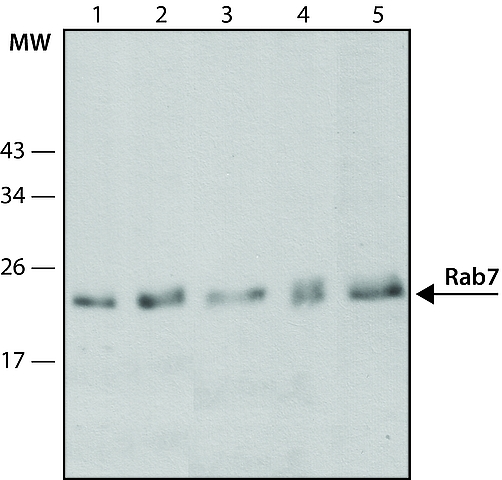 Anti-RAB7 antibody [Rab7-117] - Late Endosome Marker (ab50533) | Abcam
