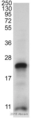Anti-RAB7 antibody [Rab7-117] - Late Endosome Marker (ab50533) | Abcam