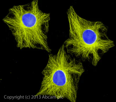 Rabbit Anti-Goat IgG H&L (Alexa Fluor® 555) preadsorbed (ab150146) | Abcam