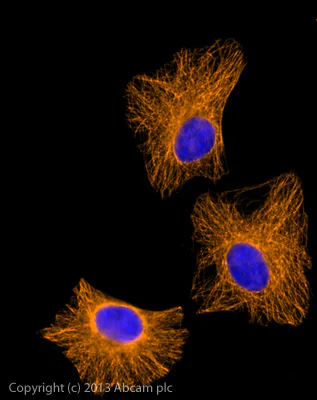 Rabbit Anti Goat (IgG) secondary antibody Alexa Fluor® 594 (ab150144 ...